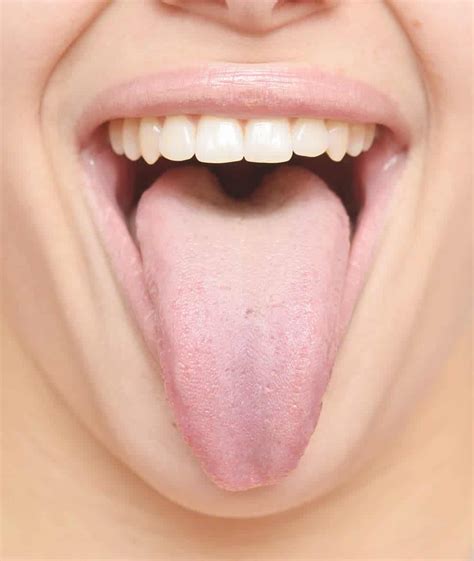 What Does Our Tongue Tell Us About Our Liver