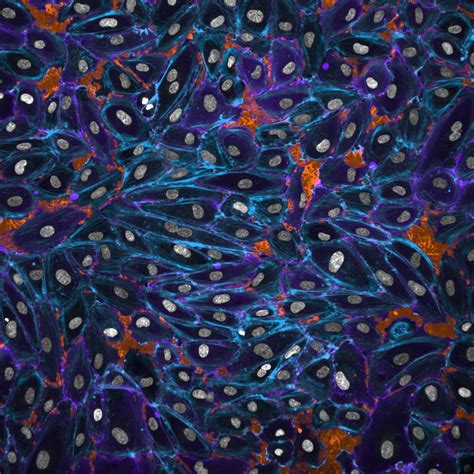 Suomen Biokuvantamisen Ennätysrahoitus Avaa Uusia Mahdollisuuksia Åbo Akademi