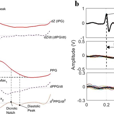 A Multimodal Biosensor With An Impedance Plethysmography Ipg Signal Download Scientific