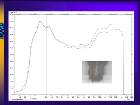 PPT IMRT Quality Assurance PowerPoint Presentation Free Download ID