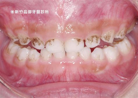 How To Use The Train I4unu Qkluh Mdec Object Detection Api