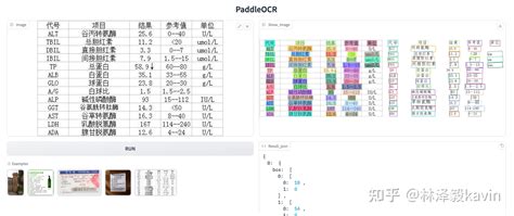 Paddleocr：轻量级文本检测识别框架 知乎