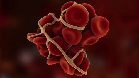 چگونه از لخته شدن خون و مرگ پیشگیری کنیم؟