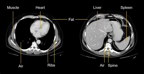 Labelled Female Ct Scan Abdomen At Rosario Miesner Blog