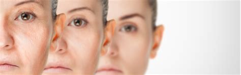 Wormbot Automating Ageing Experiments On C Elegans