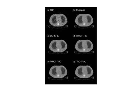 Reconstructed Attenuation Maps A Fbp Reconstruction B Pl Estimate