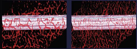 Interpreting Fractures Through 3d Seismic Discontinuity Attributes And