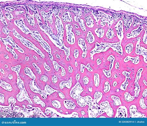 Intramembranous Bone