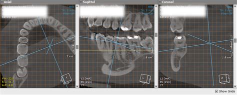 customizing the 3d orientation of the image for further measurements