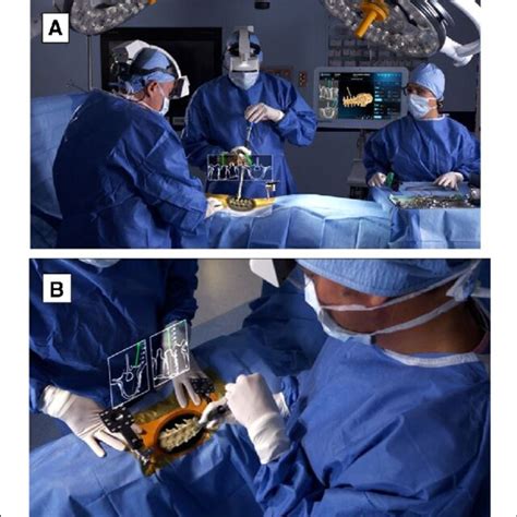 Pdf Augmented Reality For Minimally Invasive Spinal Surgery