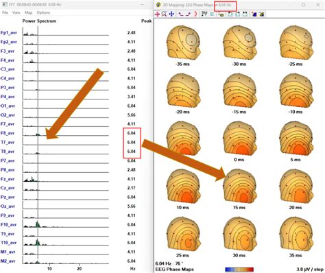 Besa® Brain Electrical Source Analysis Besa Research Besa Pipeline