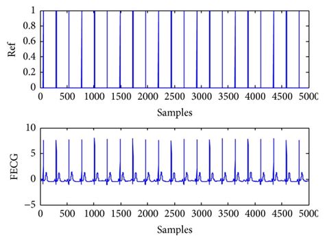 A Fetal Electrocardiogram Signal Extraction Algorithm Based On Fast One Unit Independent