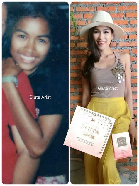 ก่อน Vs หลัง Before Vs After 🌸 Gluta Arist Thailand