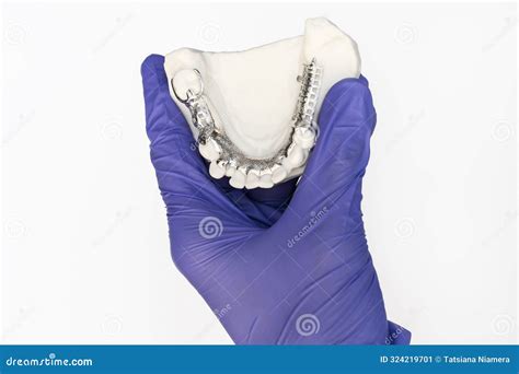Lower Partial Denture With Attachments Royalty Free Stock Image 63390244