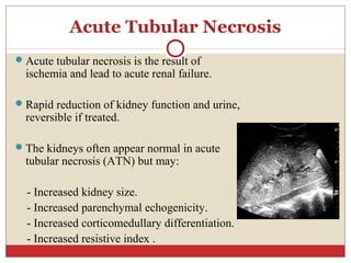 Acute Tubular Necrosis Ultrasound
