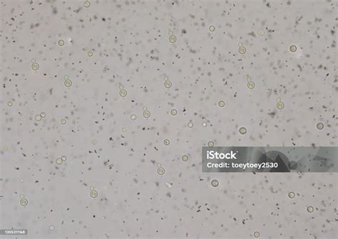 Cryptococcus Neoformans Is An Encapsulated Fungal Organism And It Can Cryptococcus Neoformans Is An Encapsulated Fungal Organism And It Can