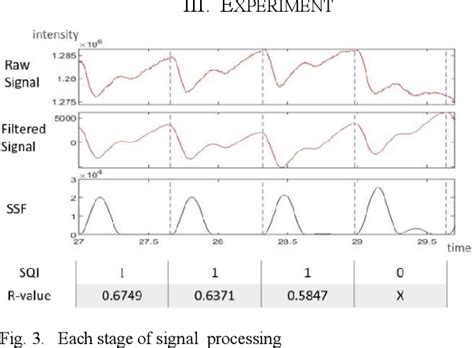 Figure 1 From Non Invasive Spo2 Monitoring Using Reflective Ppg A Low