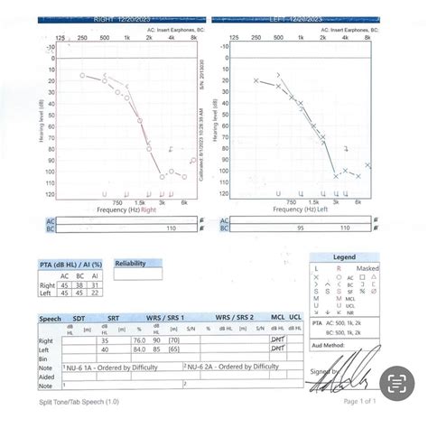 After Costco Hearing Aid Return Had Appointment Issues Hearing Aids Hearing Aid Forum
