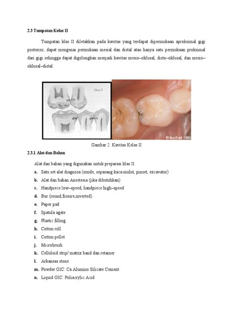 Tumpatan Gic Kelas Ii Pdf
