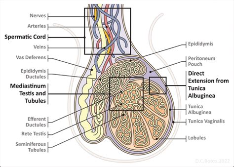 Scrotal Sac Anatomy Pure Yolk Sac Testicular Cancer Image