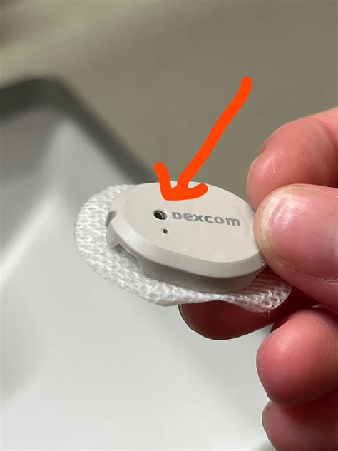 G Transmitter Insertion Failure R Dexcom