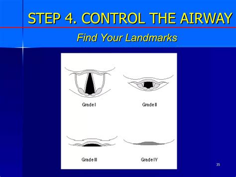Airway Algorithm Review Ppt