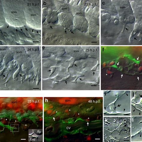 Hspc Settlement And Proliferation Differentiation In The Cht A Download Scientific Diagram