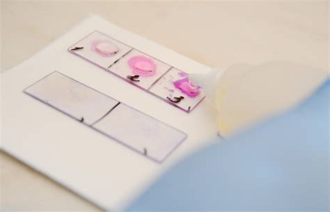 Page 26 Ema Binding Assay Images Free Download On Freepik