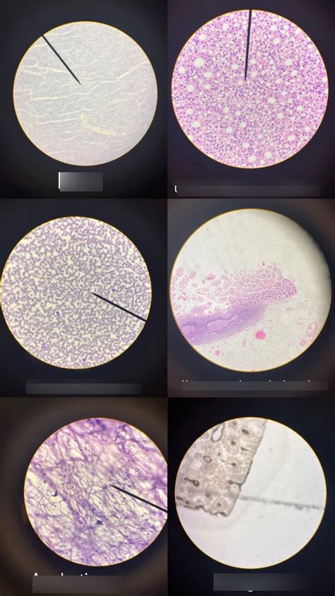 Image Labelling Exam 2 Diagram Quizlet