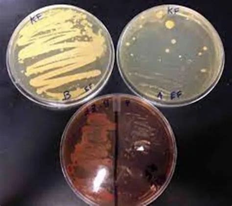 Microbiology Lab Testing Services At ₹ 35000 Sample In Ghaziabad Id 2092672997