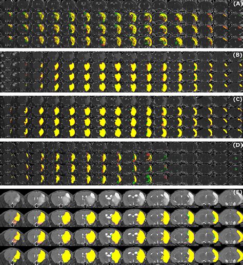 frontiers automated ischemic lesion segmentation in mri mouse brain
