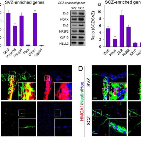 Confirmation Of Microarray Analysis A Confirmation Of Gene