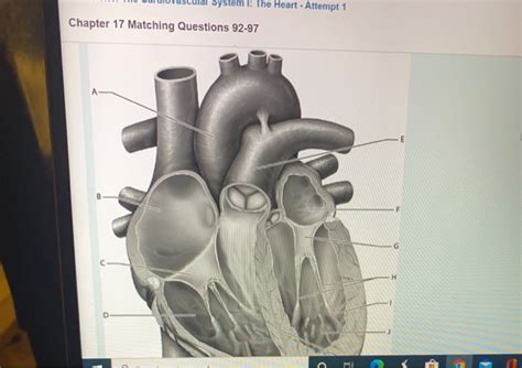 Solved System 1 The Heart Attempt 1 Chapter 17 Matching