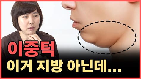 이중턱 비수술적 3가지 방법이중턱에 대한 오해 Youtube