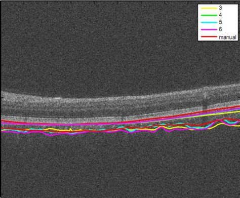 the result of image segmentation using manual segmentation and
