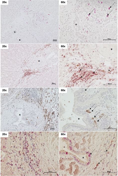 Increased Frequencies Of Intermediate And Nonclassical Monocyte