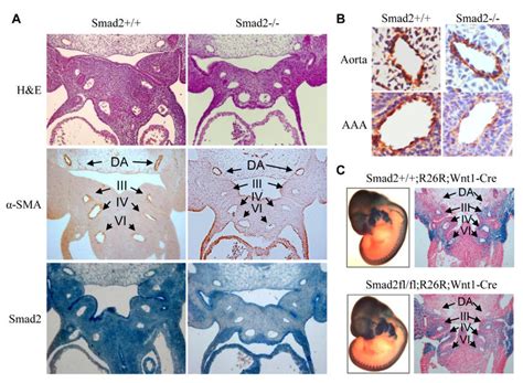 Smad2 Ncc Specific Deletion Blocked Vsmc Differentiation In Aortic Arch