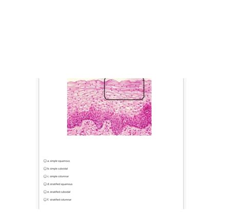 [solved] A Simple Squamous Ob Simple Cuboidal C Simple Columnar O D Course Hero