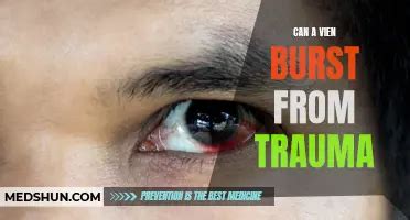 Understanding Sexual Trauma Types Effects And Healing Journey MedShun