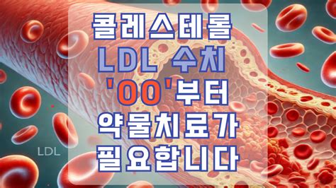 콜레스테롤 Ldl 수치 00부터 약물치료가 필요