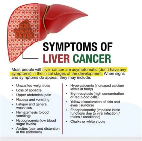 Stage 4 Liver Cancer Symptoms And What To Expect Page 2 Of 7 Anti Leukemia