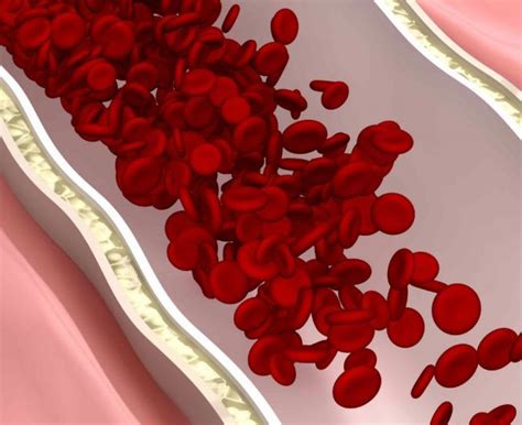 Гемоглобин в крови норма таблица по возрасту