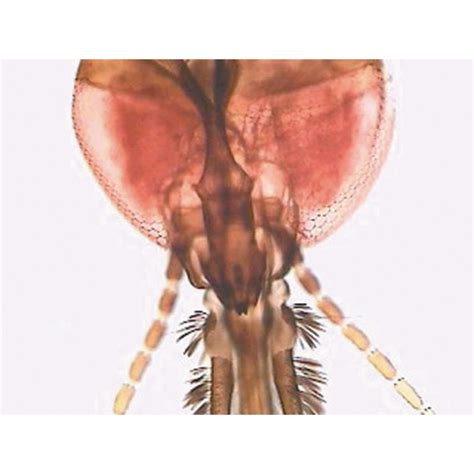 E8a10406 Philip Harris Prepared Microscope Slide Mosquito E8a10406 Philip Harris Prepared Microscope Slide Mosquito