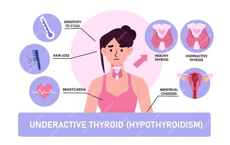 Premium Vector Hypothyroidism Sypmthoms Set Woman With Underactive Thyroide Bradycardia Hair