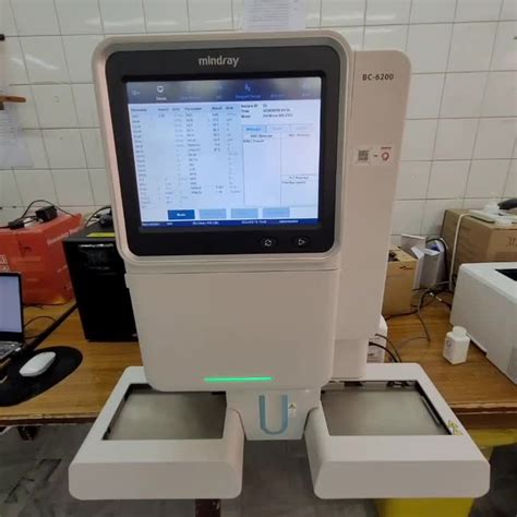 [video] Mohammad Ghaderiyan On Linkedin Lis Hl7 Astm Automation