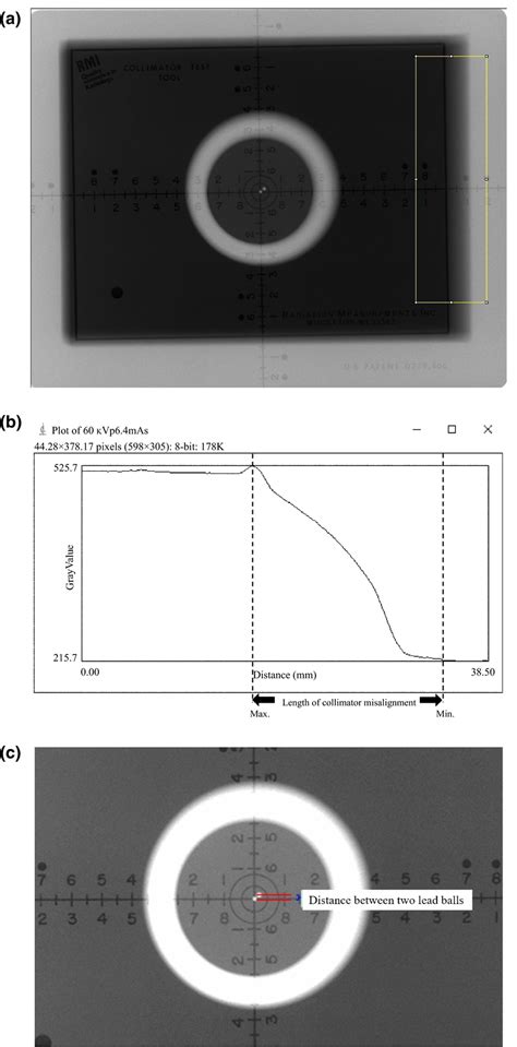 Interpretation Of The Collimator And Beam Alignments Using The Computed Download Scientific