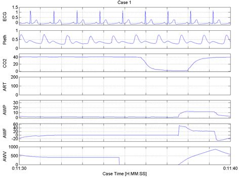 Case Waveform Plots Second Plots