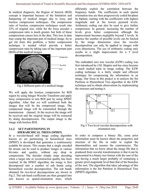 Implementation Of Brain Tumor Extraction Application From Mri Image Pdf