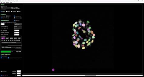 Counting Nuclei Of 3d Organoids Image Analysis Imagesc Forum