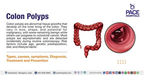 Colon Polyps Symptoms Causes Types Treatment And Prevention